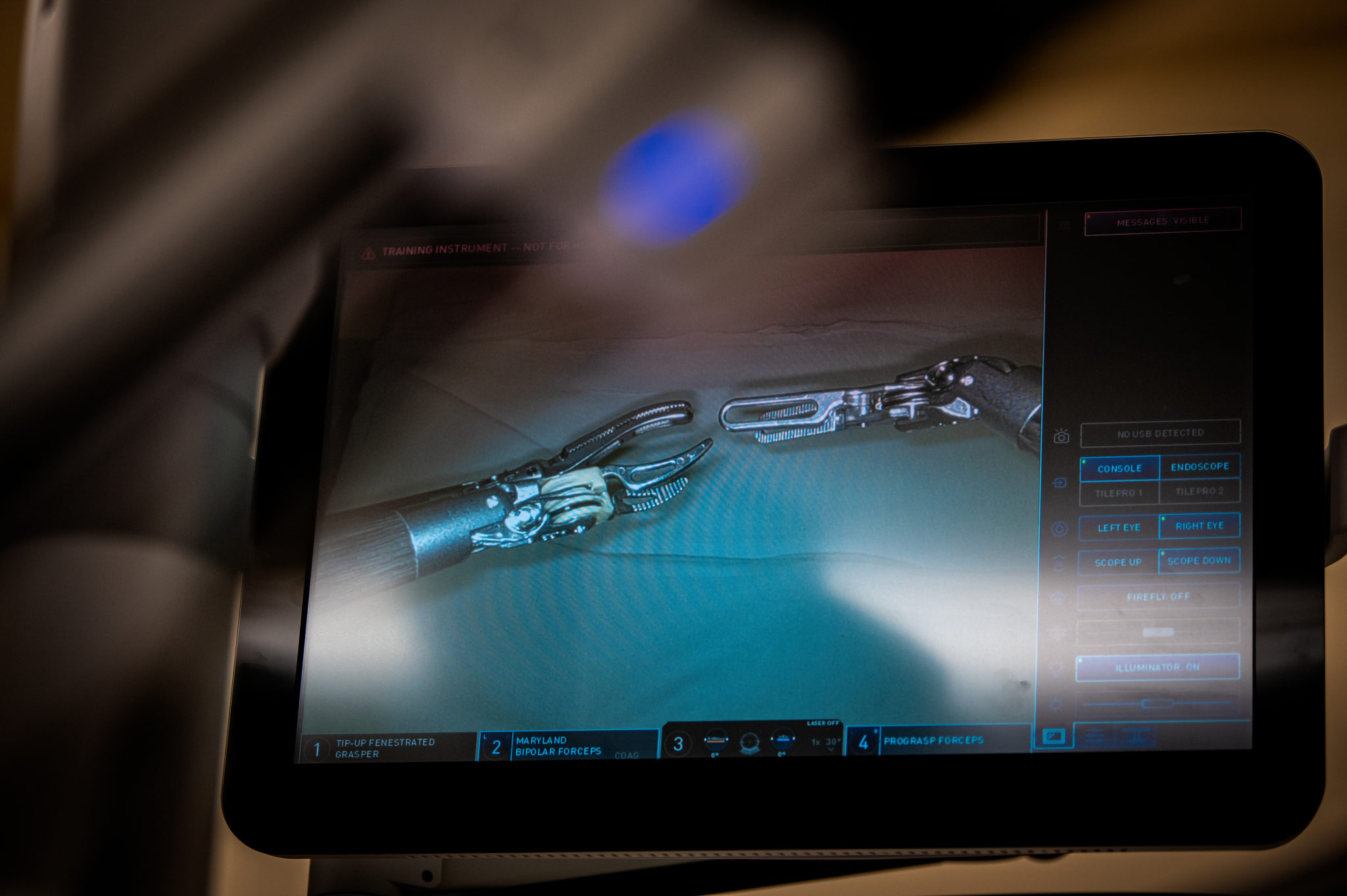 Kaiser Permanente performs its first robotic surgery in the region at ...